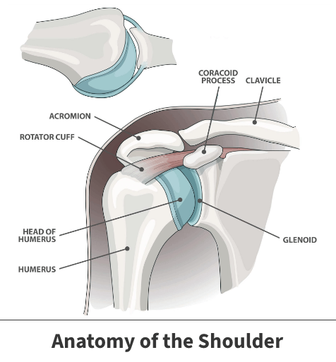 Subacromial Shoulder Impingement Syndrome Subacromial Impingement